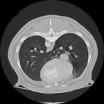 CT scans for dogs and cats 7 days a week | Advanced Vet Care Lane Cove
